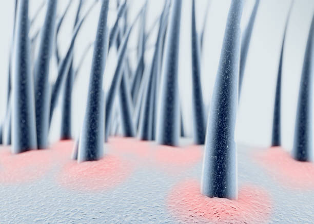 Tengo escamas en el cuero cabelludo que pican y se me cae el pelo ¿Cómo ...